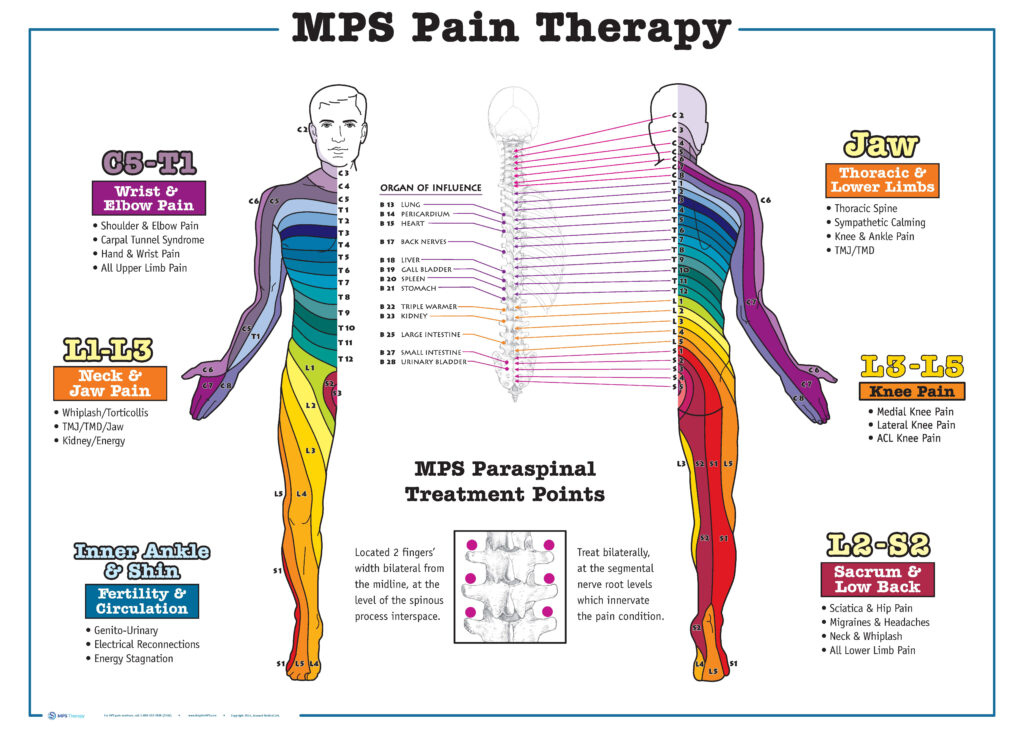 Dermatome Poster Large Dolphin Neurostim MPS Therapy | Dermatome Map