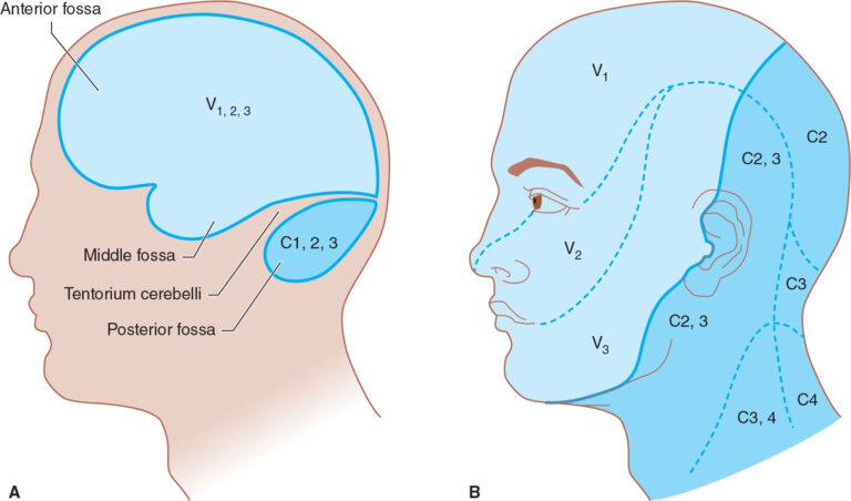 Headache Facial Pain Neupsy Key | Dermatome Map